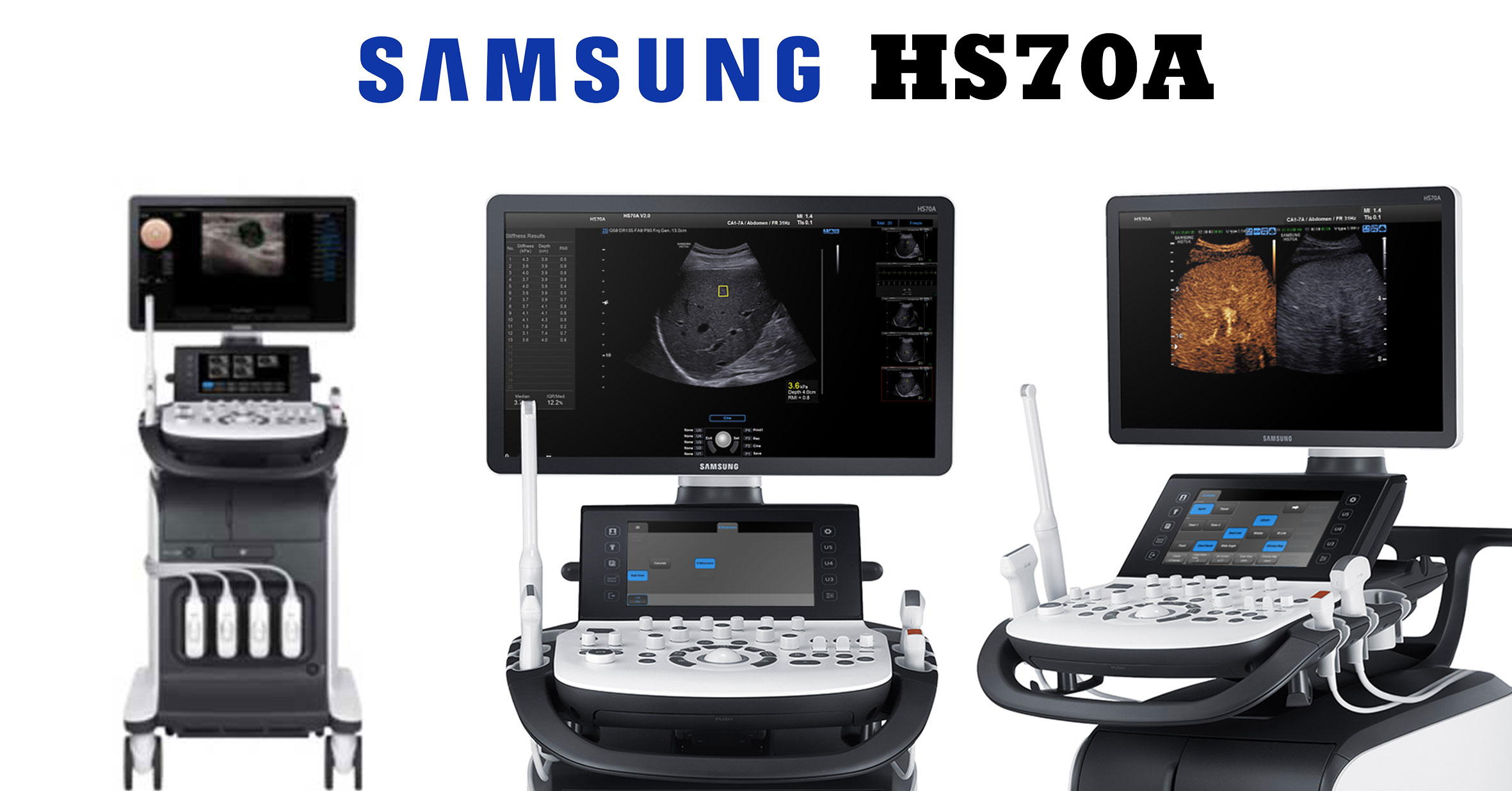 Samsung HS70A Ultrasound | دليل الأطباء Tabibiraq.com